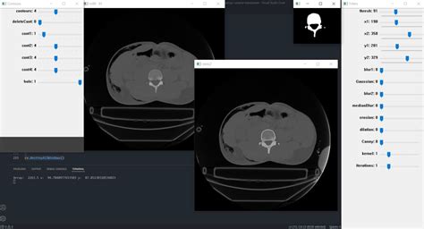 Github Krqply Medical Data Image Processing