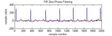 After Moving Average Filtering Download Scientific Diagram