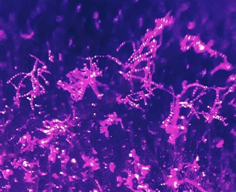 Soren Seifi Phd On Linkedin Powderymildew Cannabispathology Plantpathology