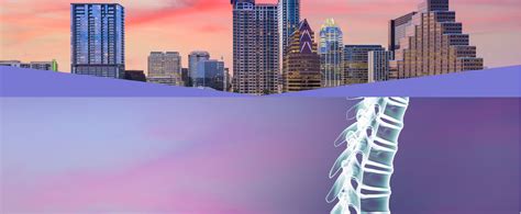 Shape Divider Between Two Images Or Gradients · Issue 3829