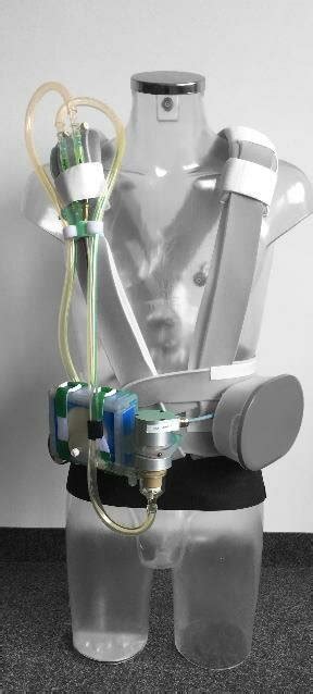 Prototype System Of Mobile Vv Ecmo System Download Scientific Diagram