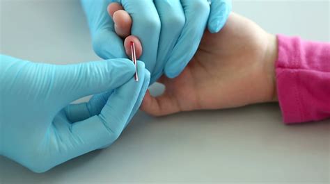 Lead Poisoning The Hidden Danger And How Screening Can Protect Your