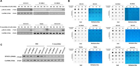 Low Dose 5 Azacytidine Induces DNA Demethylation Without DNA Damage A