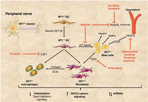 Plexiform Neurofibromas In Nf1 Plexiform Neurofibromas Pnfs Develop