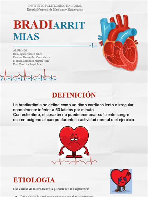 Bradicardia Urgencias Eq4 Pdf Electrocardiografia Fisiología Bradicardia Urgencias Eq4 Pdf Electrocardiografia Fisiología