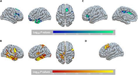 Differences In Gray Matter Structure By Group At 16 Years At The Age