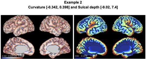 Issues With DHCP Structural Pipeline Developing Hcp Neurostars