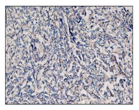 Immunohistochemical Staining Of The Phosphorylated P53 Ser20 A Download Scientific Diagram