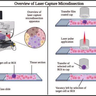 Overview Of Laser Capture Microdissection Download Scientific Diagram
