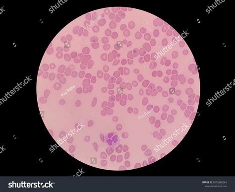 Reticulocyte Count Under X Light Microscope Stock Photo Edit Now