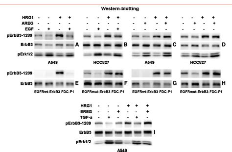 Figure 1 From Erbb 3 Ligand Heregulin 1 Is A Major Mitogenic Factor For