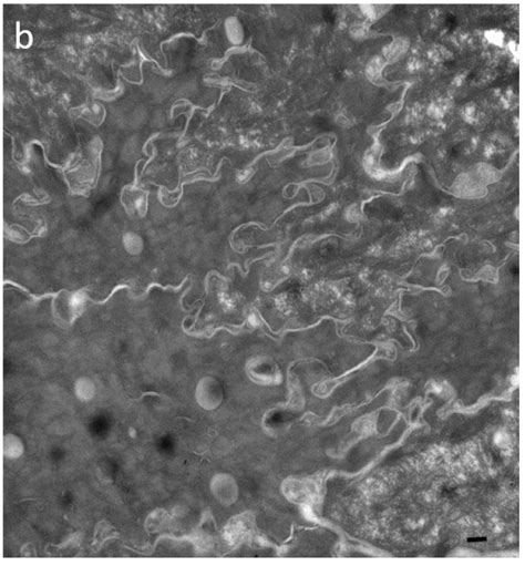 The Fate Of Epidermal Tight Junctions In The Stratum Corneum Their
