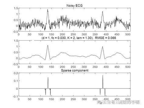 一种基于稀疏辅助模型的非平稳信号降噪方法（matlab） 知乎