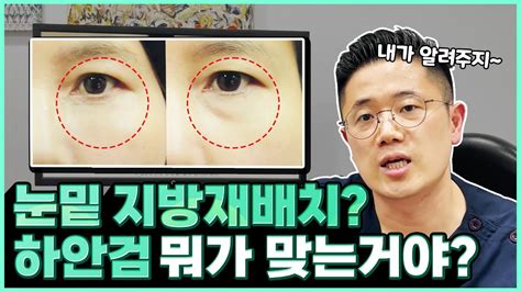 하안검수술 눈밑지방재배치 어떤거 해야 하나요 Youtube
