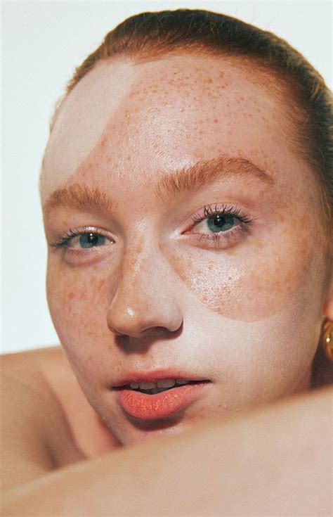 Cosmopolitans Holy Grail Acne Awards Cosmopolitan U S