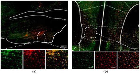 Brain Sciences January 2024 Browse Articles