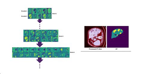 github sourjya261 livertumor segmentation w net