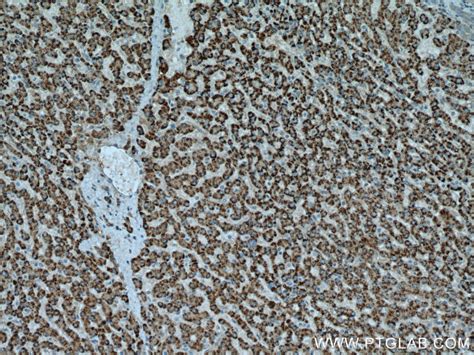 Acox1 Antibody 10957 1 Ap Proteintech 武汉三鹰生物技术有限公司