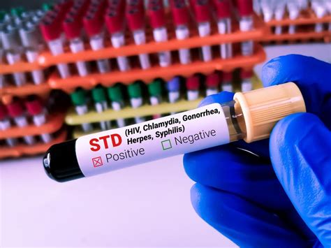 At Home Std Tests Safety And Effectiveness With Ribbon Checkup