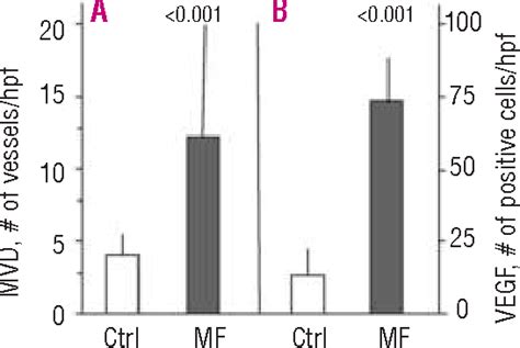 Bone Marrow Scintigraphy Semantic Scholar