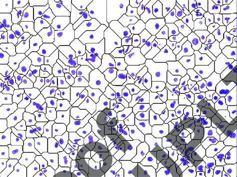 Illustration Of The Final Step Of The Watershed Algorithm Application