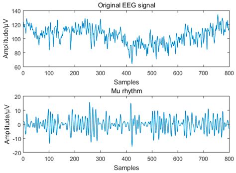 Electronics Free Full Text Eeg Feature Extraction Based On A Bilevel Network Minimum