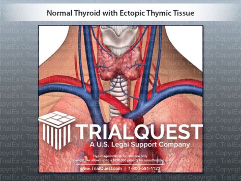 Normal Thyroid With Ectopic Thymic Tissue Trialquest Inc