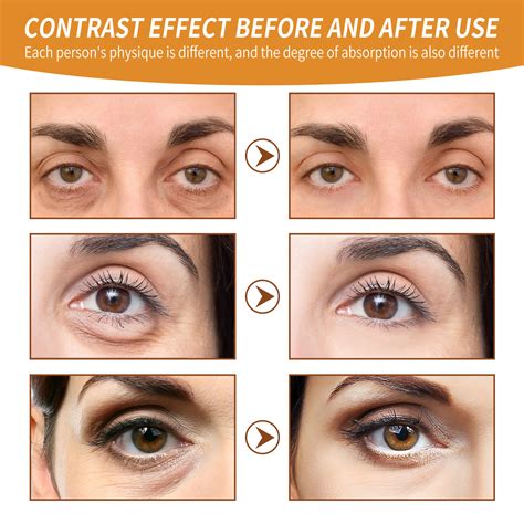 Under Eye Roller With Caffeine Vitamin C And Peptides Energizing Eye