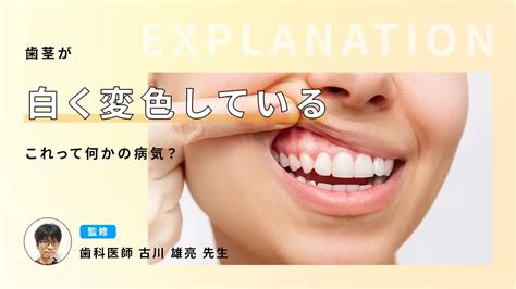 歯茎が白く変色している これって何かの病気？ 審美歯科ネットプラス
