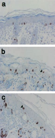 Hyperproliferation In The Skin Of Nontransgenic Mice K14e6 Wt Line