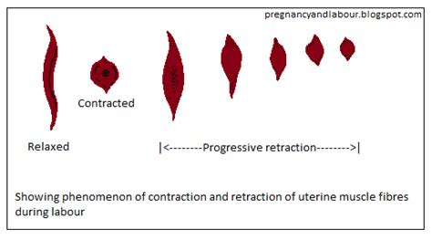 Pregnancy Labour Uterine Contraction And Retraction Contractions