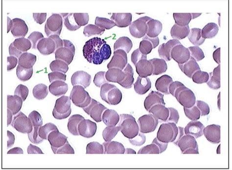 Blood Cell Identification Slides Flashcards Quizlet