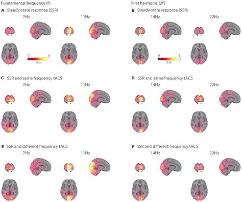 Grand Average Functional Brain Activity Power Evoked By The Visual