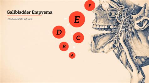Gallbladder Empyema By Nabila Afandi On Prezi