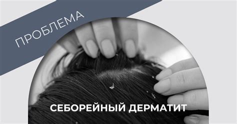 Себорейный дерматит: решение проблемы | Клиника доктора Садыковой