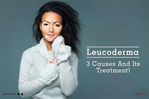 Leucoderma 3 Causes And Its Treatment By Dr Gaurav Nakra Lybrate