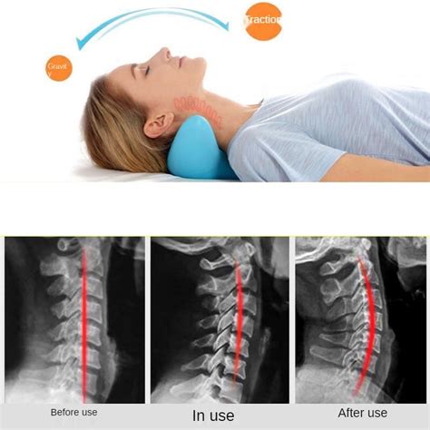 Cervical Spine Massage Pillow Gravity Acupressure Neck Massa Inspire Uplift