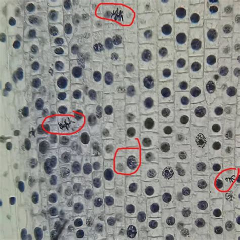 Onion Root Tip Mitosis Clear Stages For Education