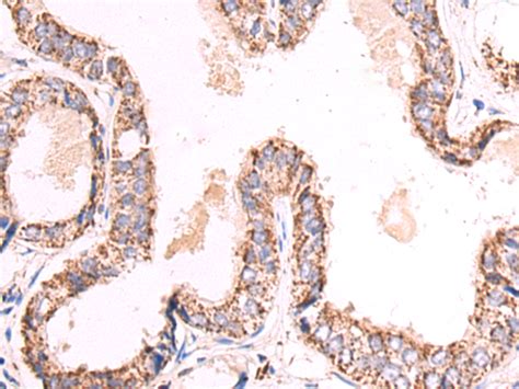 兔抗got2多克隆抗体anti Got2 Rabbit Polyclonal Antibody 生命科学产品与技术服务 生工生物工程上海