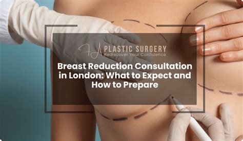 Breast Reduction Consultation In London What To Expect And How To