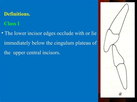 Classification Of Normal Occlusion And Malocclusion Ppt Dental