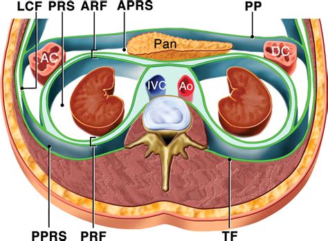 Imaging Of Uncommon Retroperitoneal Masses Radiographics