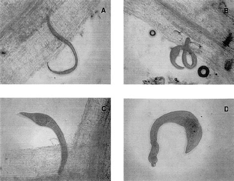 Four Development Stages Of Rotylenchulus Reniformis Female A Download Scientific Diagram