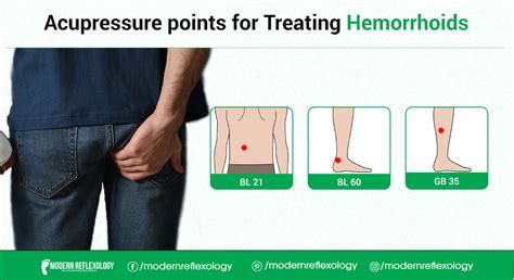 Acupressure Points For Treating Hemorrhoids Modern Reflexology
