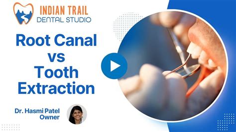Root Canal Vs Tooth Extraction Which Is Better
