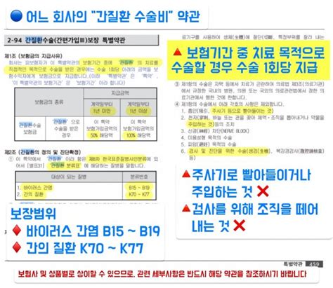 간질환수술비 보험약관 및 알릴의무의 쉬운 설명