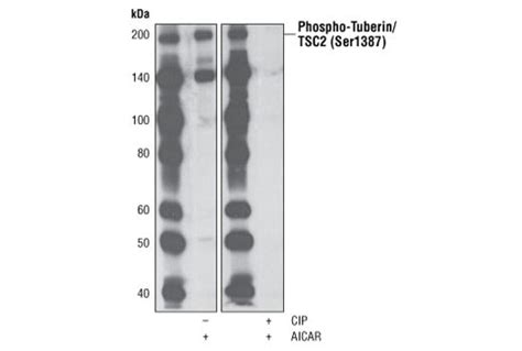 Phospho Tuberintsc2 Ser1387 Antibody Cell Signaling Technology