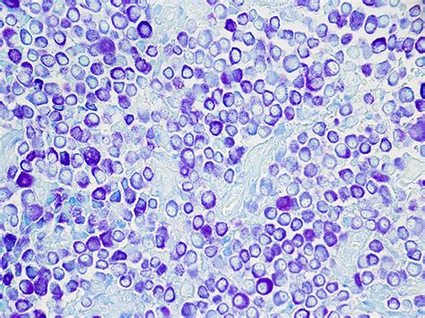 Mast Cell Histology Slides Animal