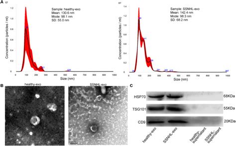 Differentially Expressed Mirna Profiles Of Serum Derived Exosomes In