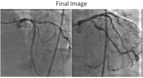 Tctap C 172 Oct A Friend With Benefit Jacc